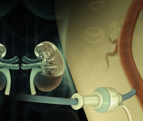 Global Kidney Academy: CKD-Associated Pruritus (CKD-aP)