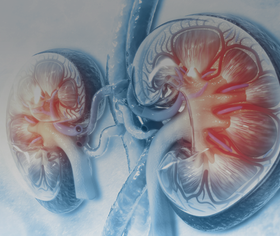Global Kidney Academy: ANCA-Associated Vasculitis (AAV)