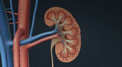Global Kidney Academy: ANCA-Associated Vasculitis (AAV)