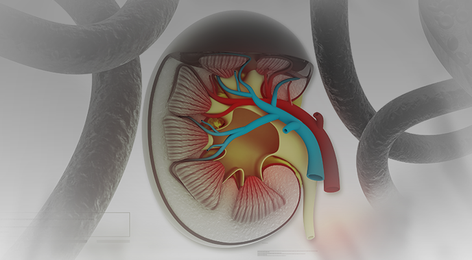 Global Kidney Academy: ANCA-Associated Vasculitis (AAV)