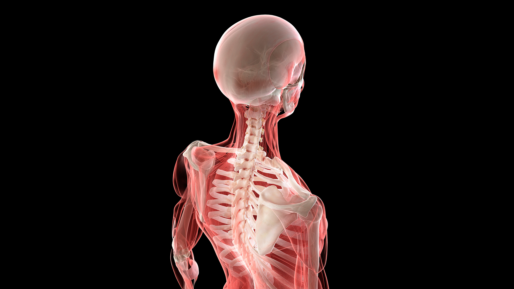 Musculoskeletal Disorders - Global Kidney Academy